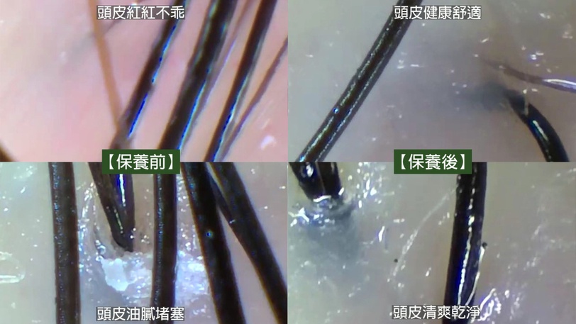 顏值防塌靠養髮！【INNEX植萃賦活】絕地反擊頂上危機，迎接夏天「頭皮頭髮不分手